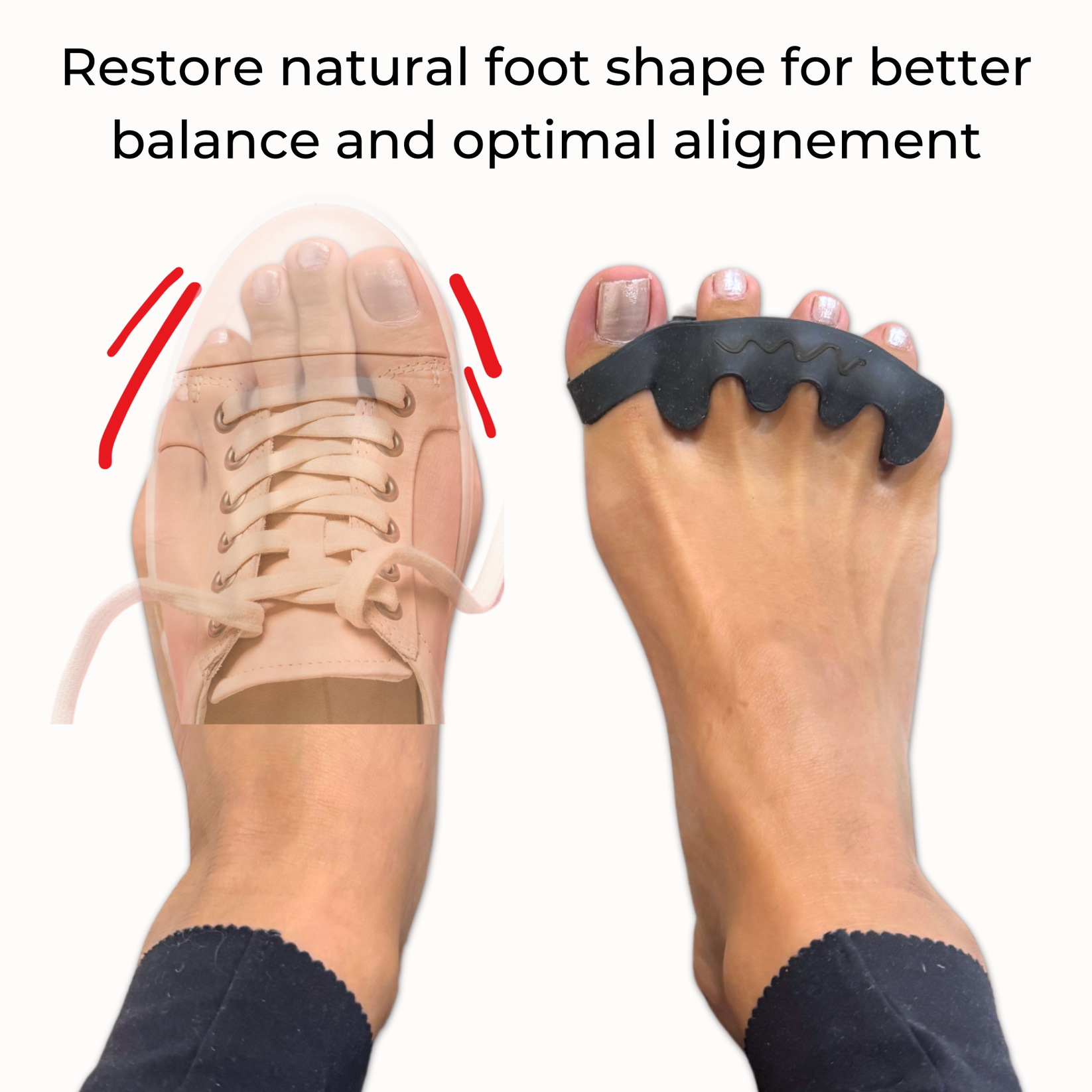 The Toe Spacer – Spacer Mobility